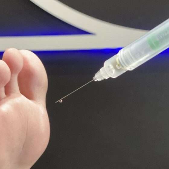 Curacorn® Dermal Fillers Glasgow - La Preme